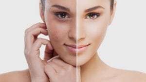 The 10 Most Common Skin-Damaging Habits You Need to Break Now - K ...